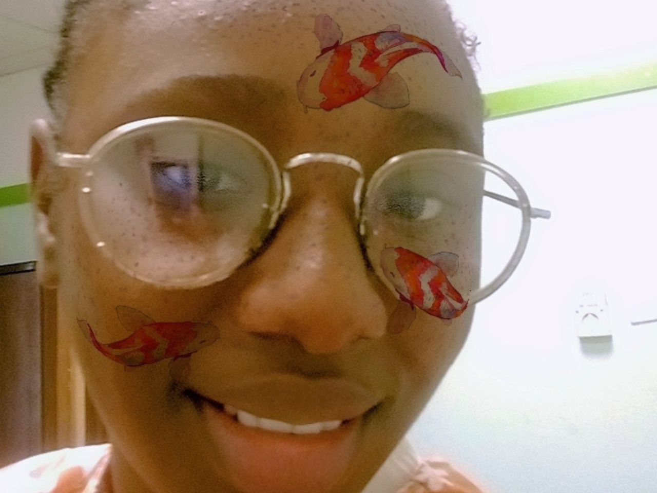 Rarer than rare: Glanzmann thrombasthenia in Nigeria - Haemnet